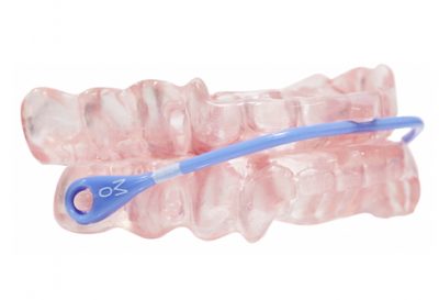 SomnoMed Oral Appliance for Obstructive Sleep Apnea - Sleep Dynamics ...